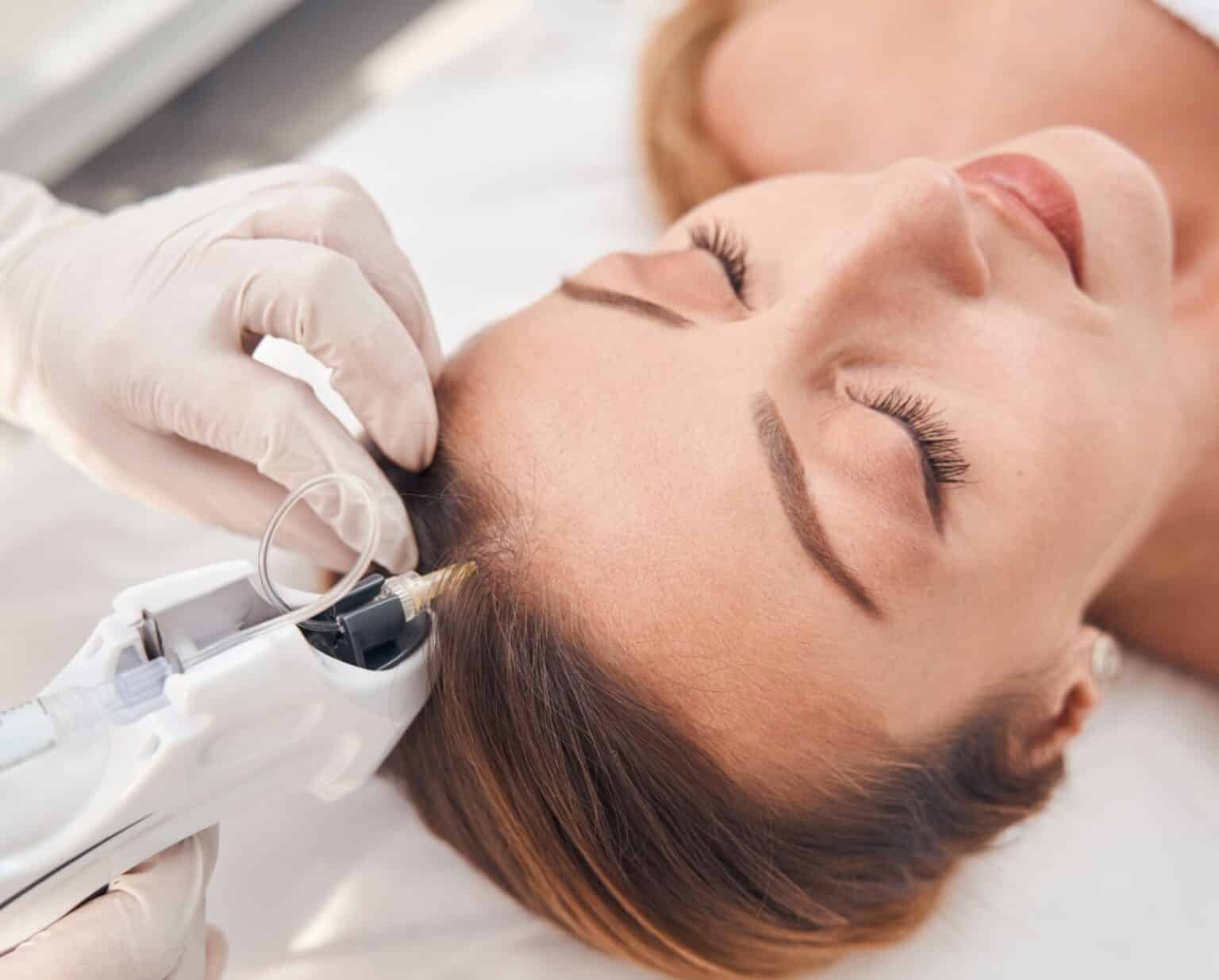 Mésothérapie capillaire, traitement cheveux | Paris | Laserio