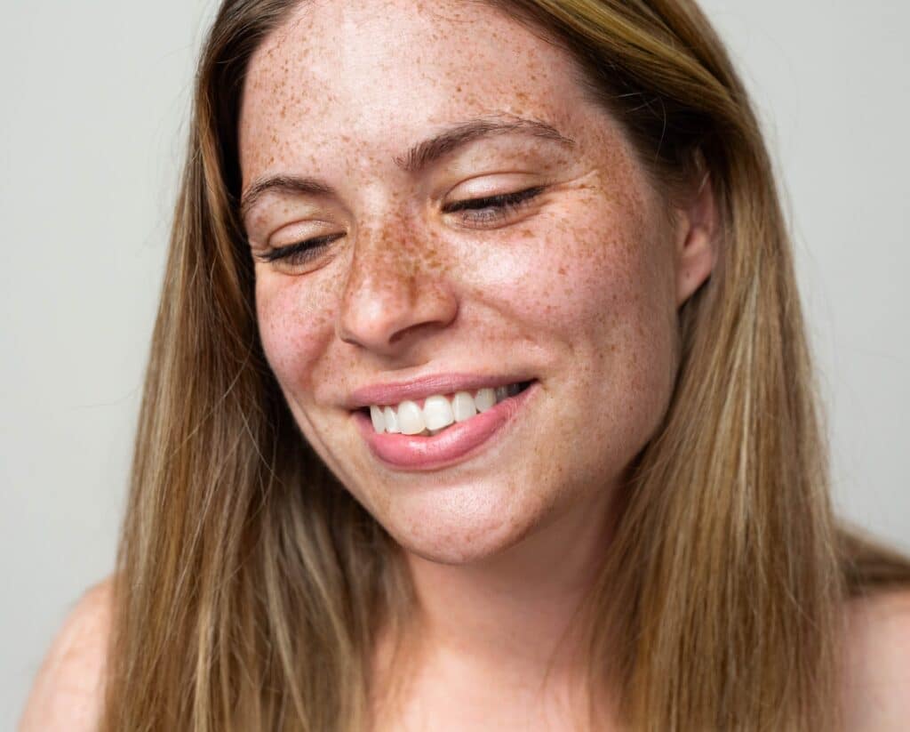 Traiter les taches brunes : peelings et laser | Laserio | Paris